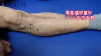 董氏奇穴侧三里侧下三里,治疗面瘫_偏头痛等症状