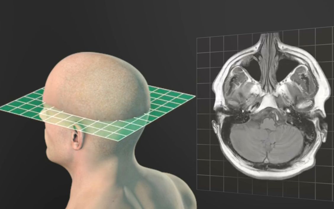【3D演示】解剖结构术语(原版+字幕版)