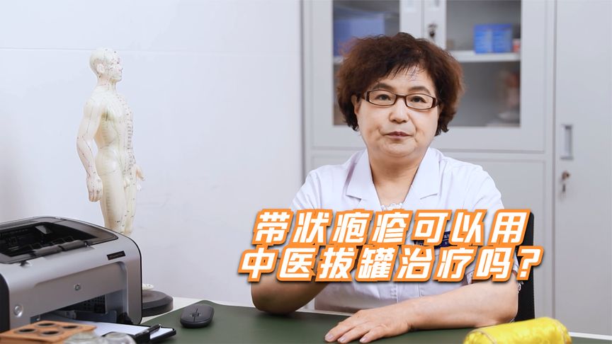 带状疱疹可以用拔罐治疗吗?医生:刺络拔罐可缓解疼痛,排出淤血