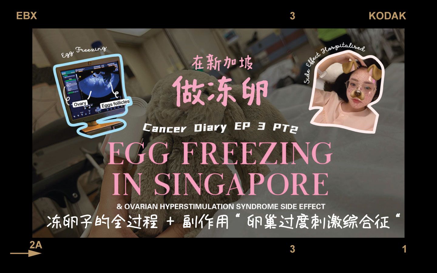 ✦ENG/中✦ 癌症日记03 Pt2: 在新加坡做冷冻卵子的全过程 + 副作用“...