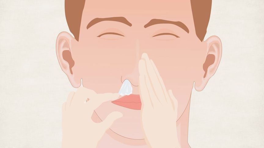 流鼻血怎么止血?专家:推荐这几种方法