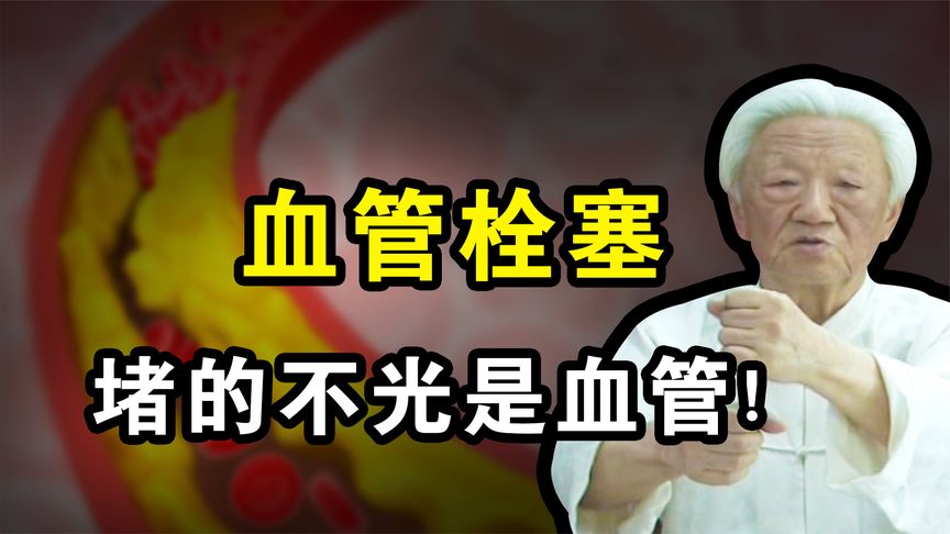 血管栓塞,堵住的可不是一根血管!末端的神经和组织更会遭殃