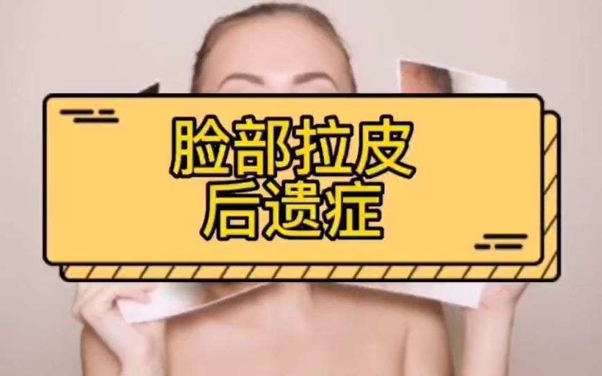 小心踩坑!脸做拉皮的后遗症,拉皮手术后会有哪些后遗症?