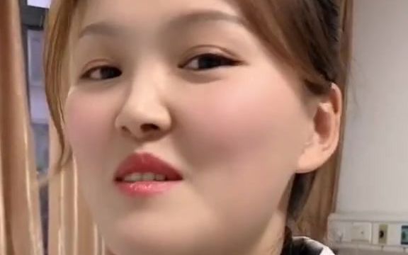 环切手术三。每次看到美女护士换药伤口都会崩开,也不知道伤口啥...