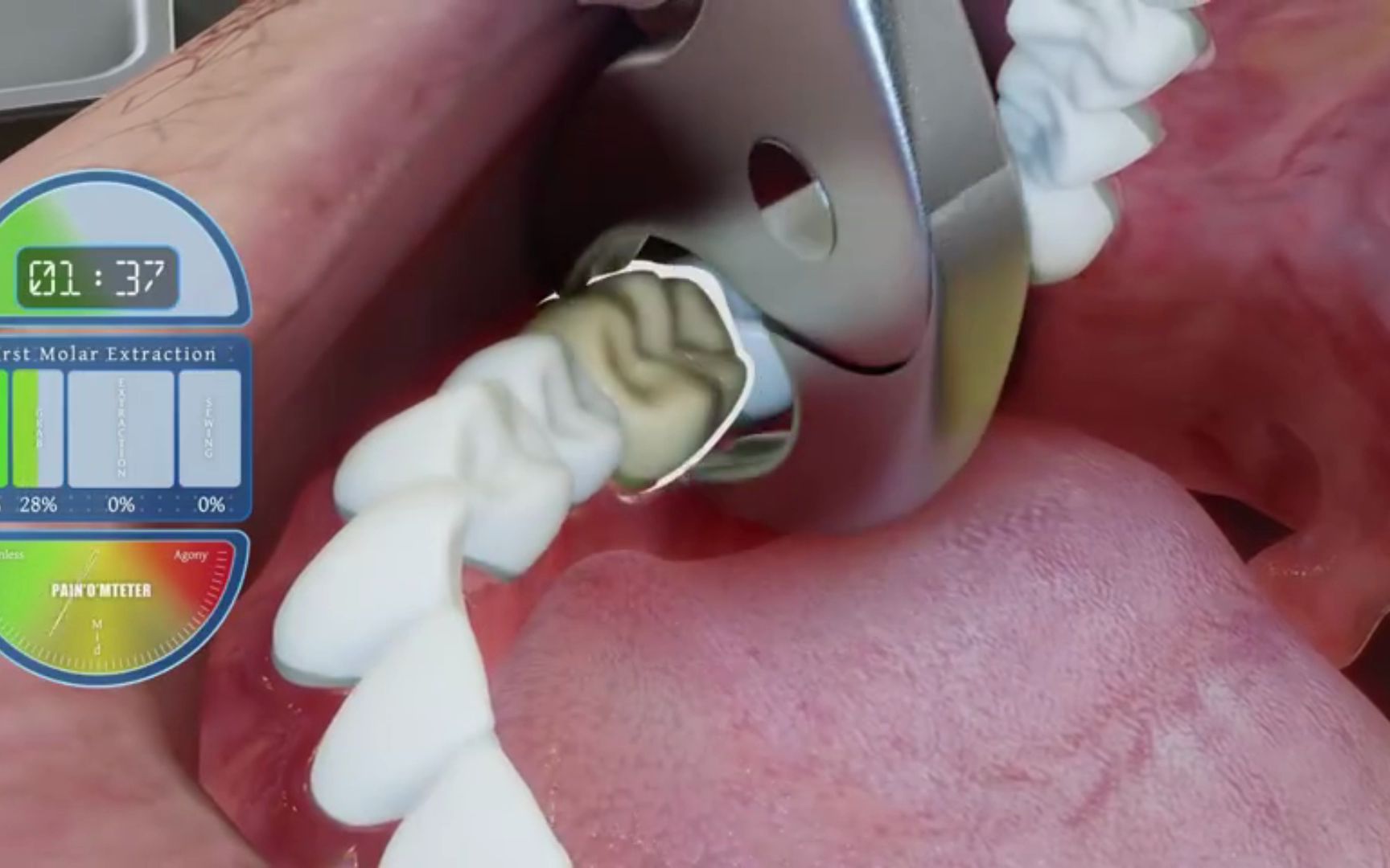 真正的牙医模拟器