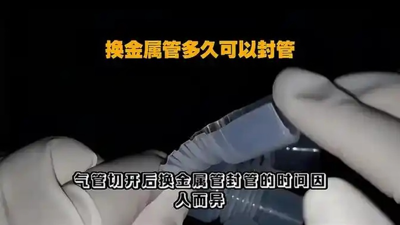 换金属管多久可以封管