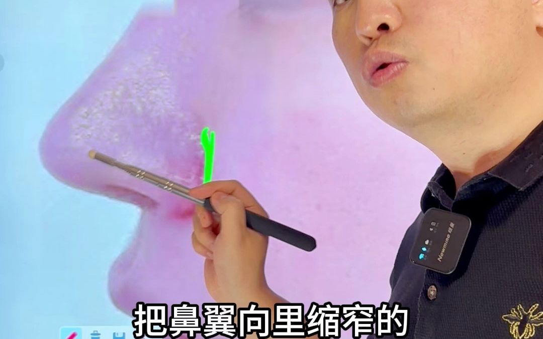 鼻部攻略|鼻翼缩小不留疤怎么做