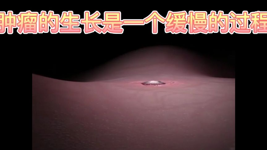 从细胞水平看肺癌的生长过程,肿瘤是如何一步步扩大势力范围的!