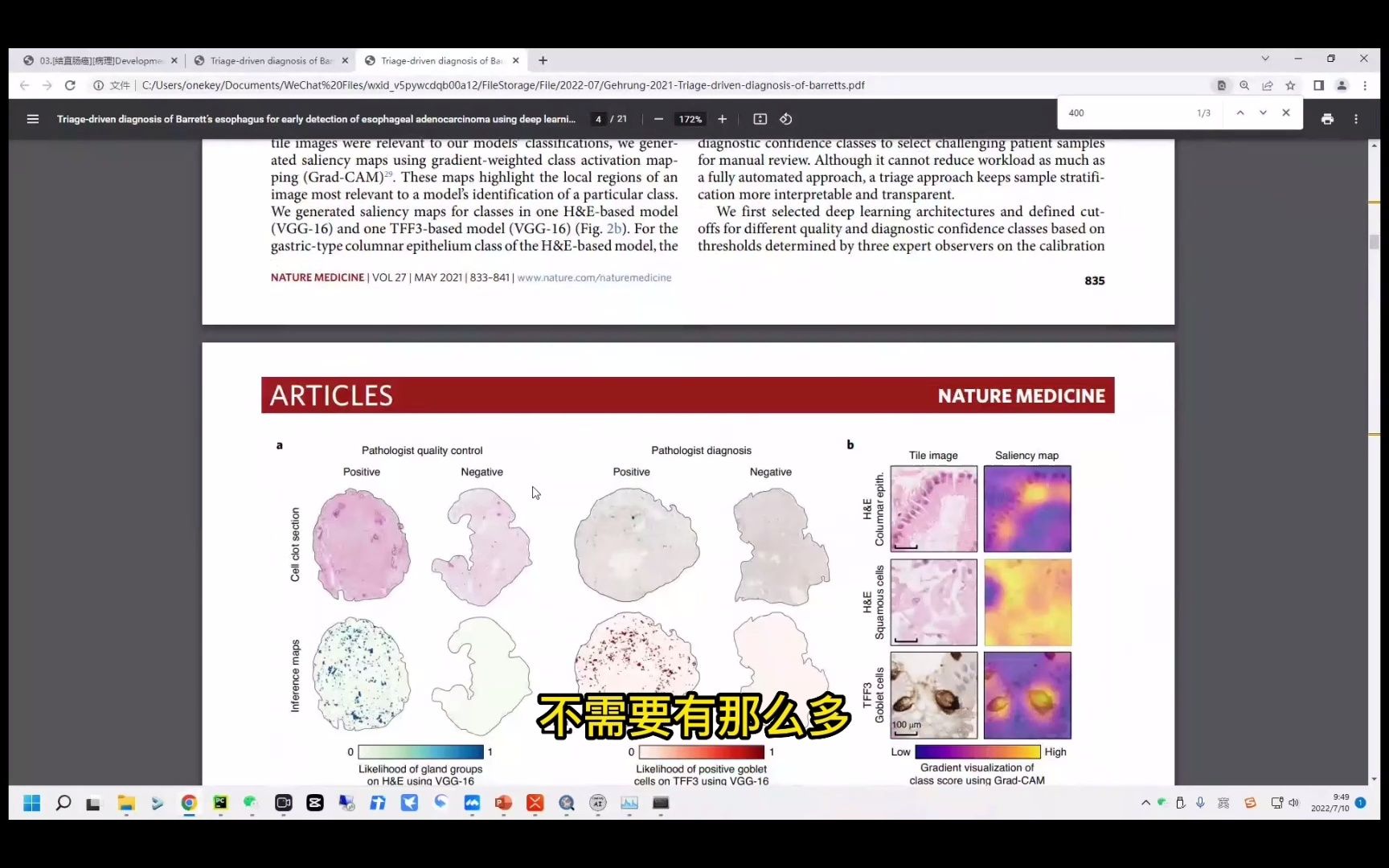 通过影像组学工具如何快速实现食管癌病理CT数据标注