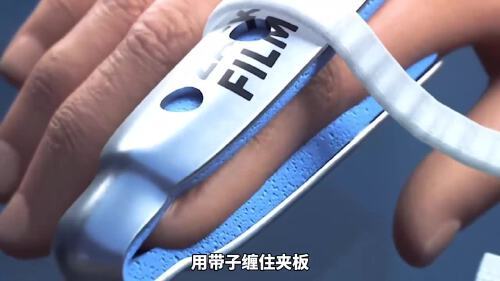 手指骨折别慌张!急救处理5步骤,避免二次伤害速收藏