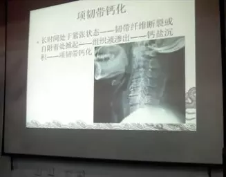 ...治疗各种疼痛、内科疾病--- - 软组织损伤 筋膜学6--中医针灸正骨推拿...