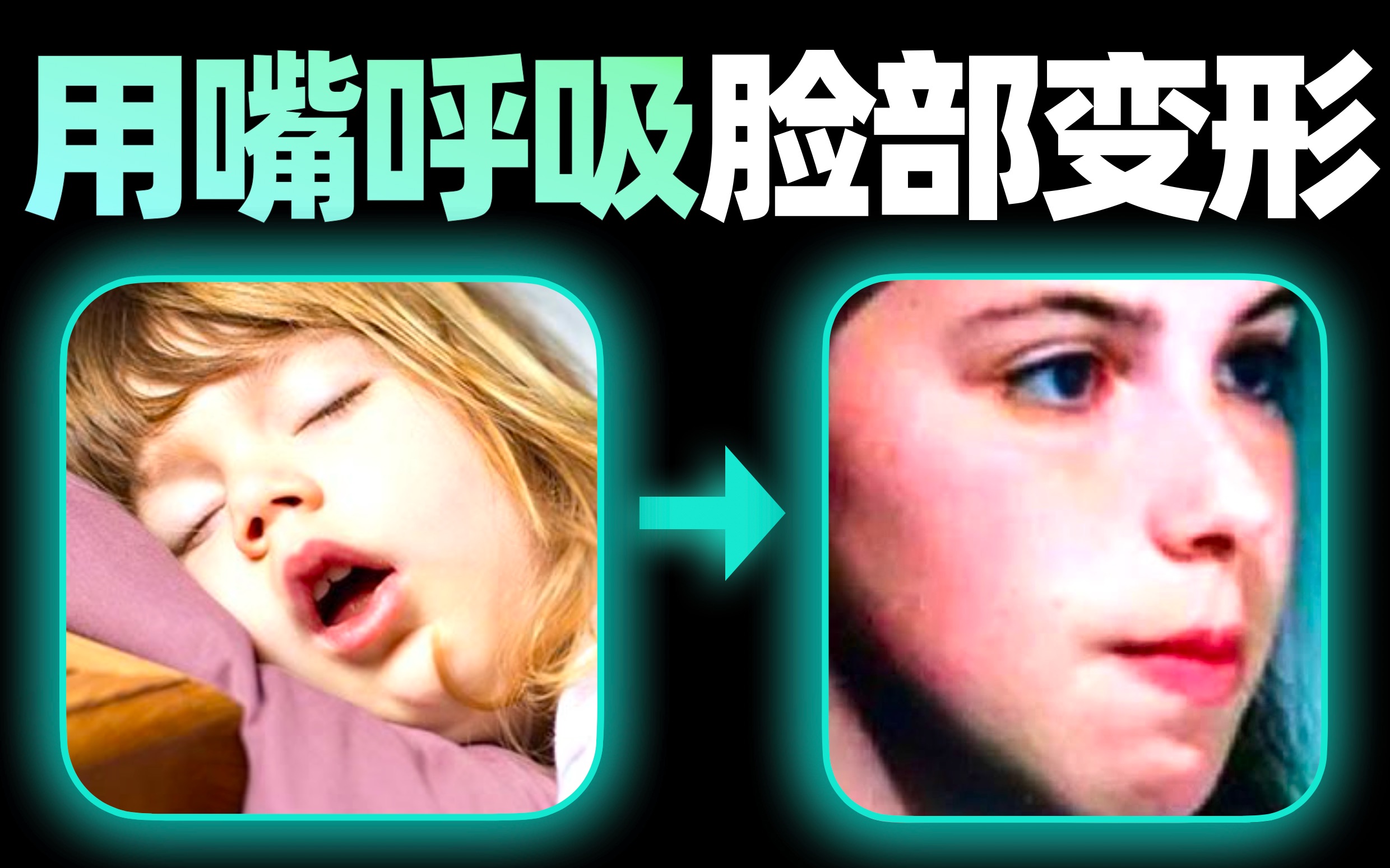 睡觉千万别用嘴呼吸!嘴凸/脸长/下巴后缩,你不知道的口呼吸危害