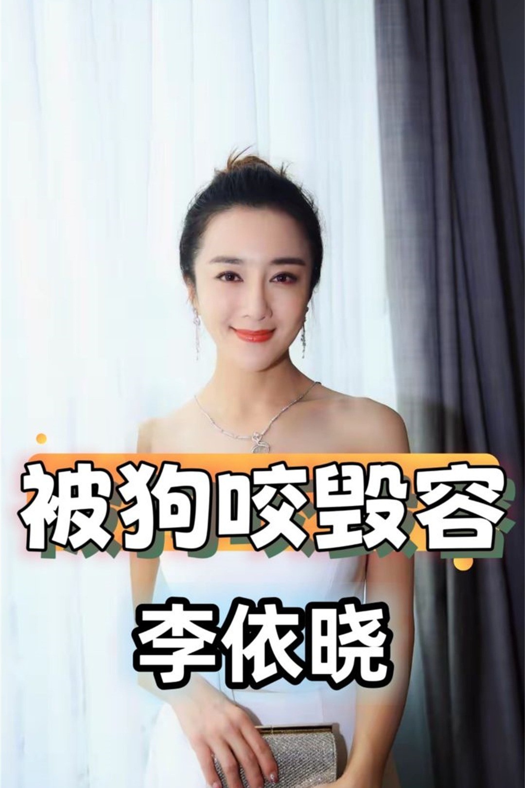 10年后,再看被闺蜜狗咬到毁容的李依晓,被后遗症折磨苦不堪言