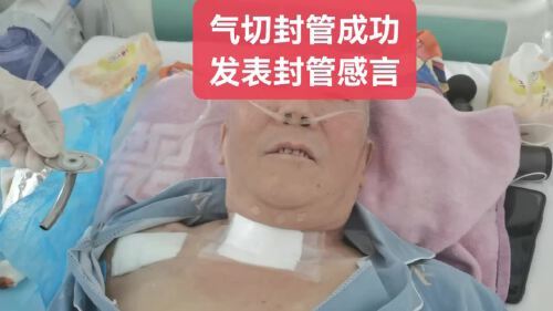 白肺重症肺炎气切封管成功发表封管感言