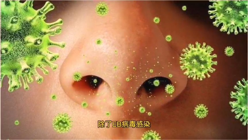 EB病毒和鼻咽癌有什么关系?感染了应该怎么办