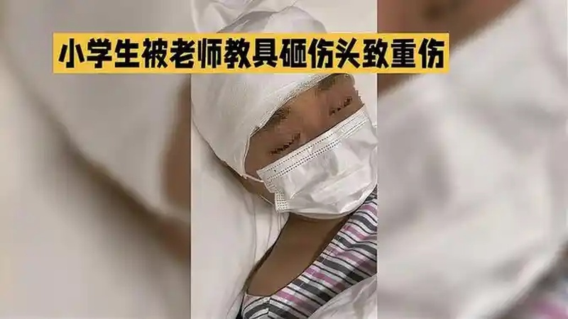 小学生被老师教具砸伤头致重伤