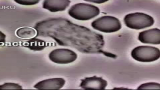 Neutrophil attacts on bacteria 嗜中性粒细胞攻击细菌_标清