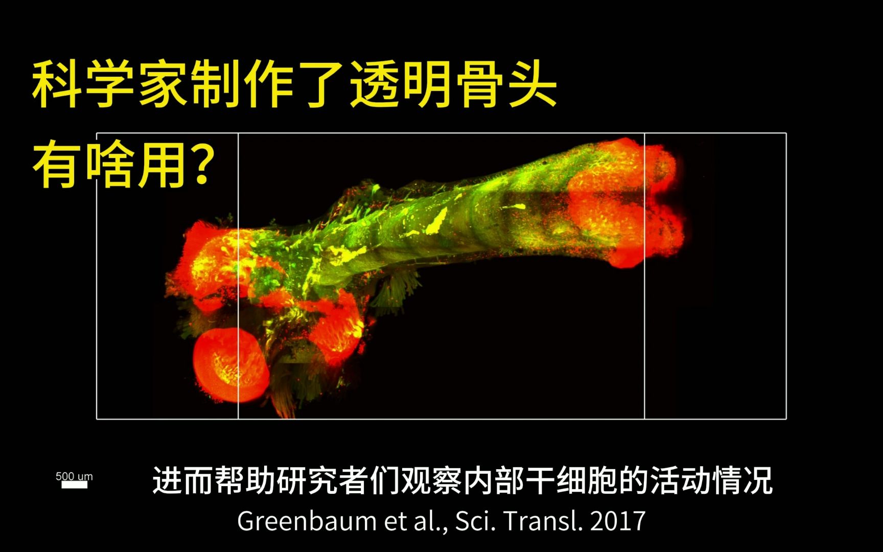 ...透明化多色三维成像,运用光片显微镜可直接透视观察骨髓中的干细胞