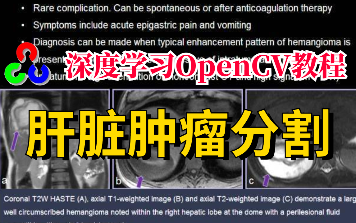 ...教程,究极详细,含PPT+代码,完全自学都能跑通!-肿瘤图像分割、...