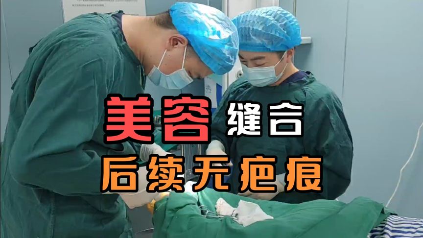 大脚骨手术做好了,拇外翻矫正啦!美容缝合不用拆线无疤痕