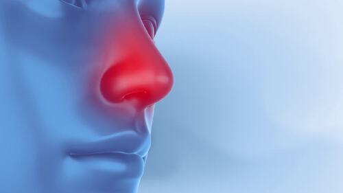 鼻子出血别慌张!3步紧急止血法能救急