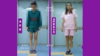 清国中医崔清国针刀治疗走路难看 外八字脚 臀肌挛缩证
