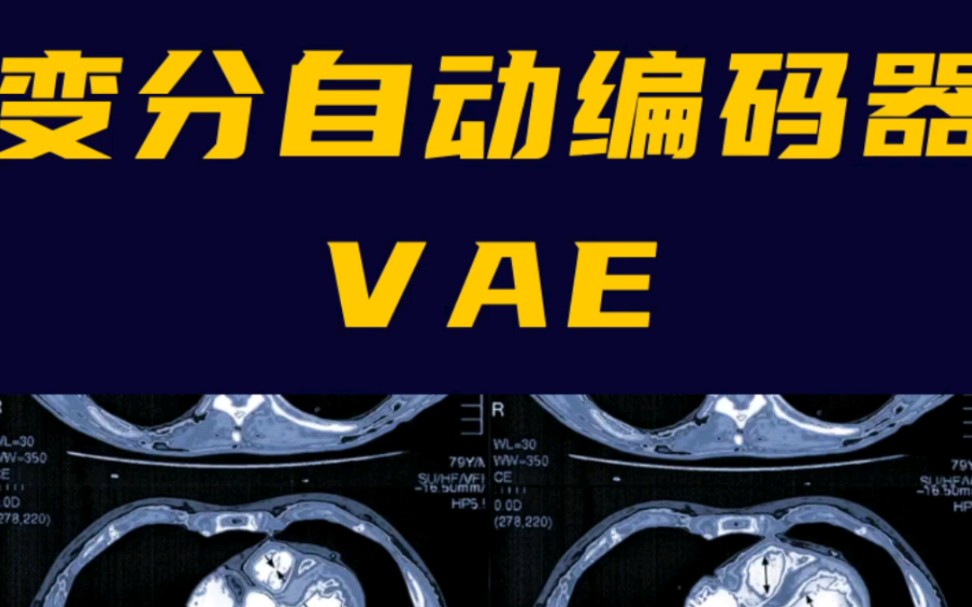 变分自动编码器(Variational Autoencoder)VAE#物联网平台研发#AI#AI...