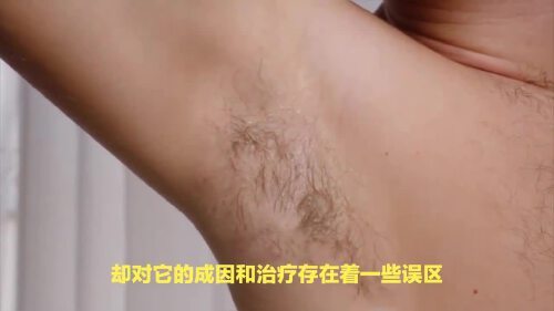 告别狐臭困扰!从根源到日常的全周期管理指南