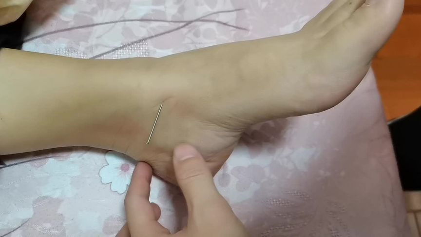 商丘透丘墟,一针透两穴
