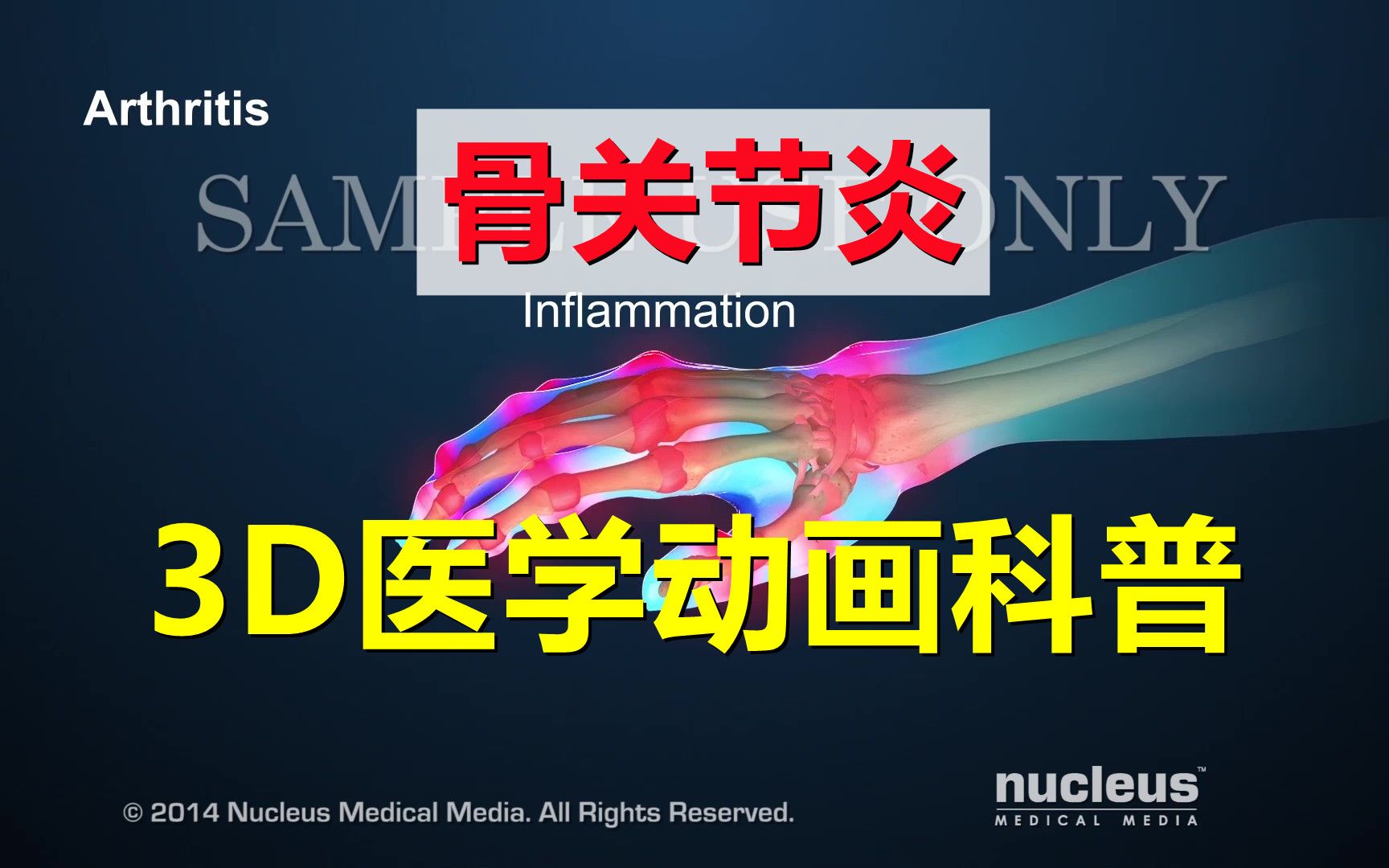 【3D医学动画科普】骨关节炎(中英双语字幕)