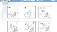 喉罩使用手册(国内)