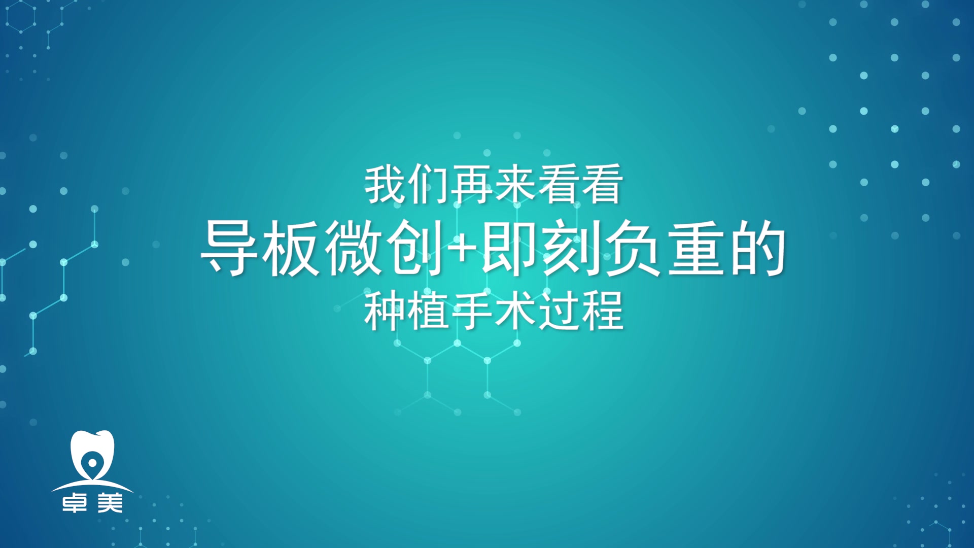 4分钟教你了解口腔传统种植与导板微创种植的区别