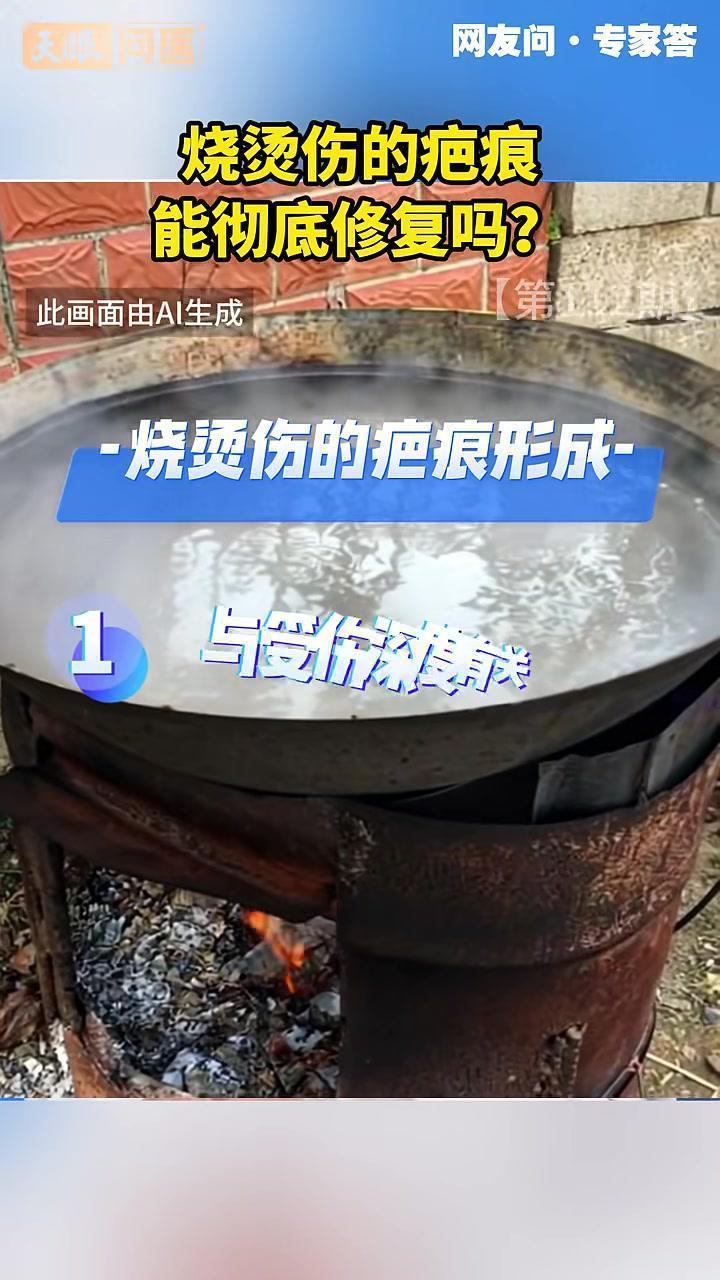 烧烫伤的疤痕能彻底修复吗?(记者:吴兵制作:郭睆秋)