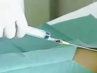 中心静脉压测定方法(视听教材)