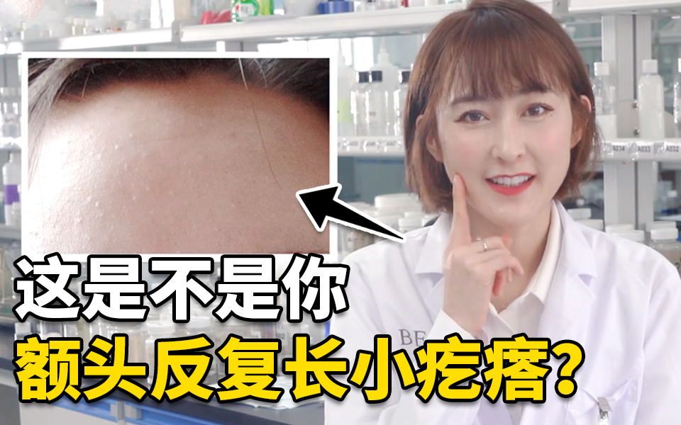 千万别挤!反复长痘不用怕!硬块型痘痘这样解决!没有痘坑痘印!解决方案!
