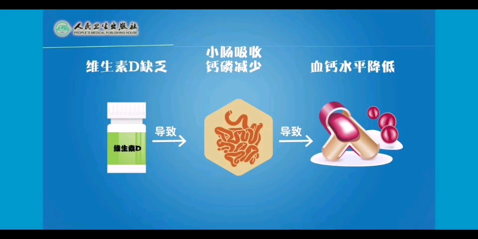 【儿科学】维生素D缺乏性佝偻病发病机制