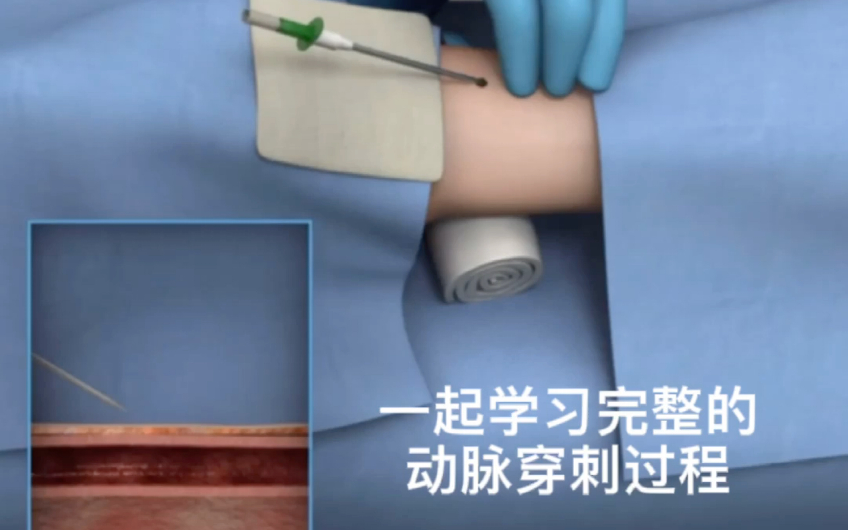 医学生必备技能之动脉穿刺置管