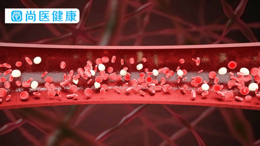 主动脉瘤不是肿瘤,症状不易发现,身体发生这些改变要警惕
