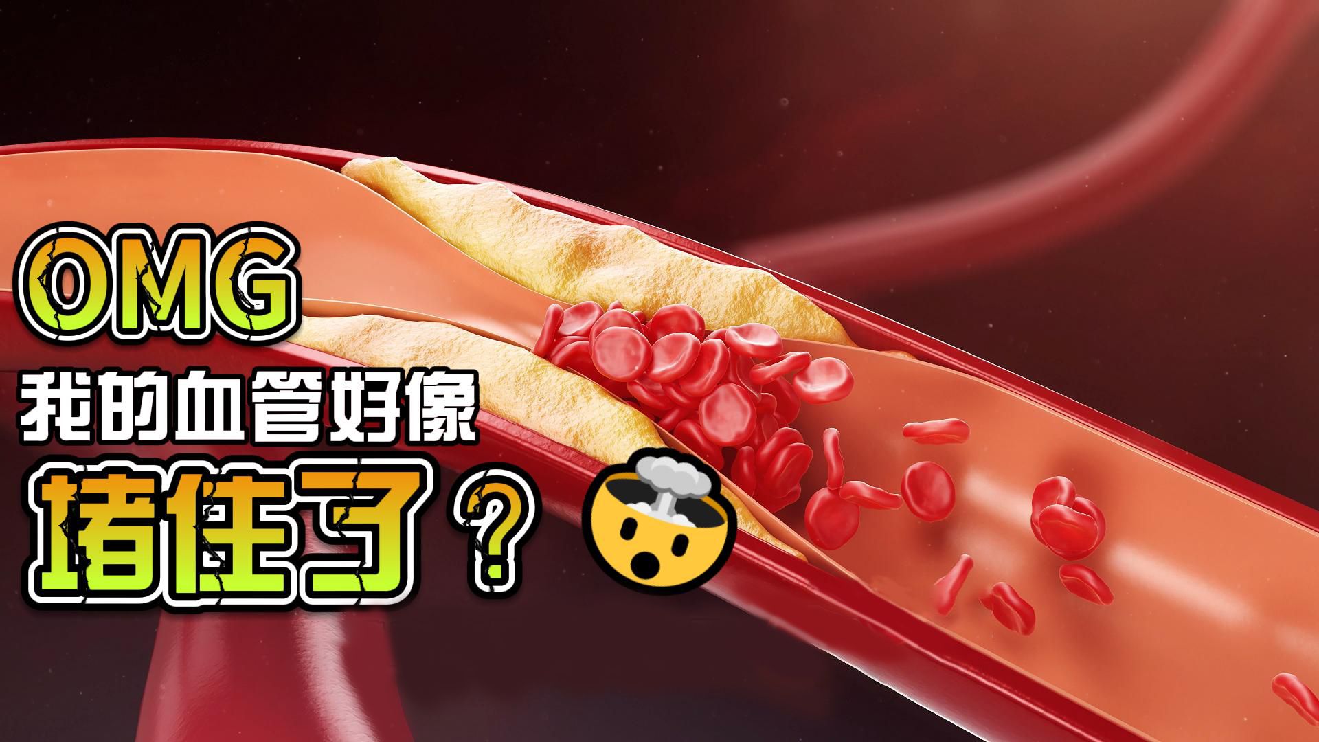 三维动画演示 | 动脉粥样硬化全过程