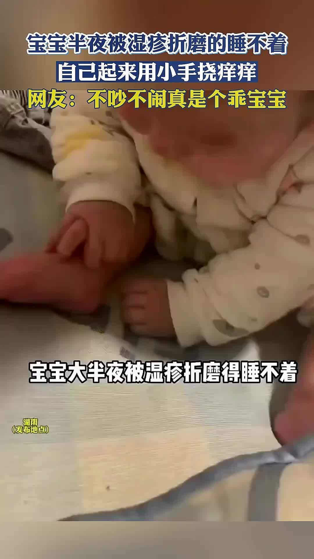 宝宝半夜被湿疹折磨的睡不着,自己起来用小手挠痒痒,好乖啊!