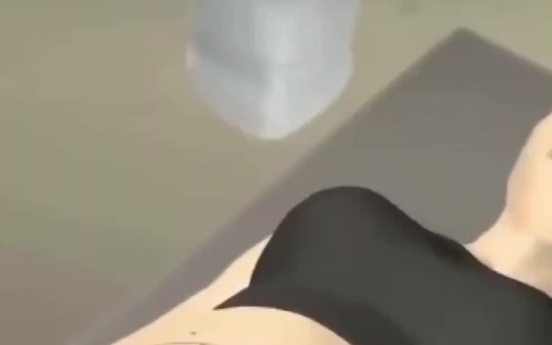 56动画演示抽脂术全过程