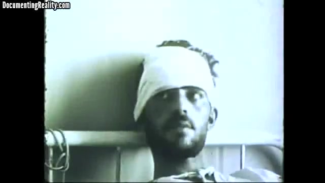 实拍一个得了狂犬病的人(致死率100%)