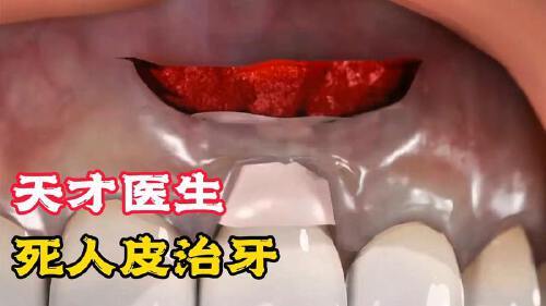 死人皮治牙?揭秘天才医生如何用皮肤再生术拯救你的牙齿!