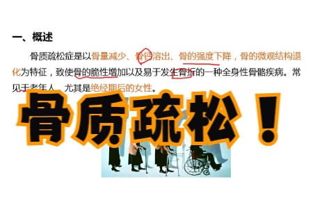 肌肉骨骼系统和结缔组织疾病-第八节-骨质疏松
