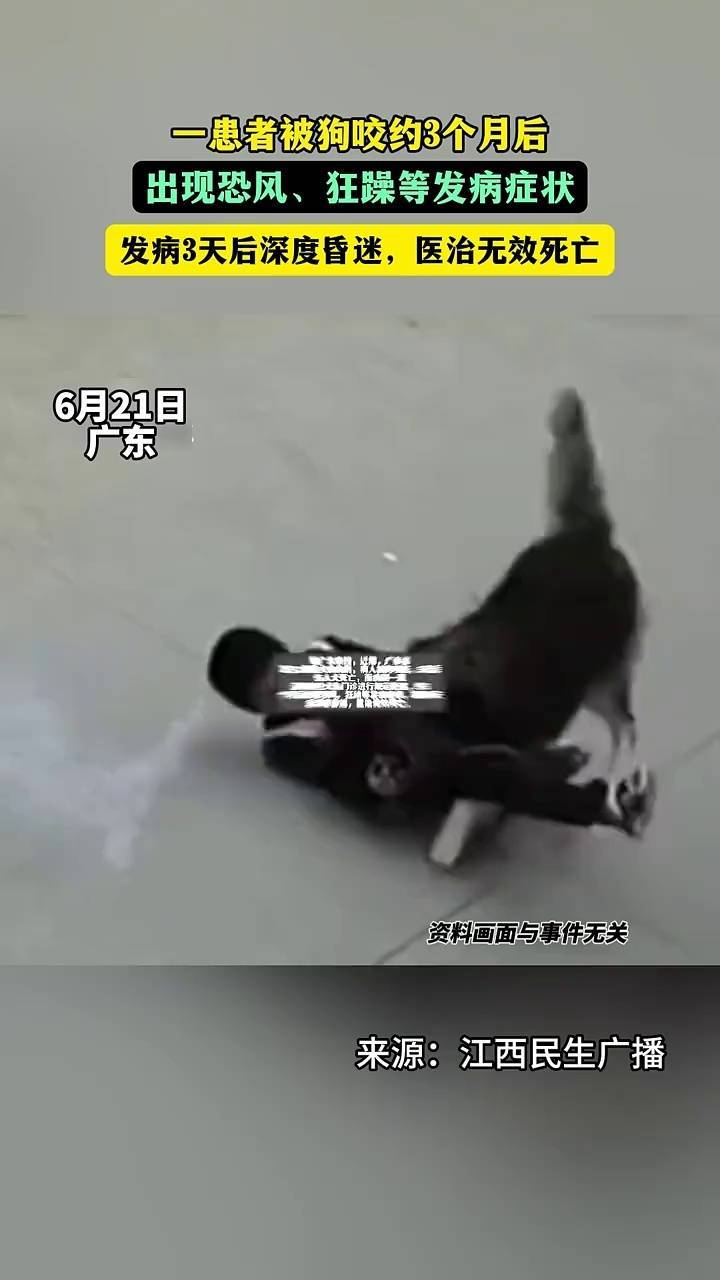 患者被狗咬约3个月后出现恐风、狂躁等发病症状,发病3天后深度昏迷,...