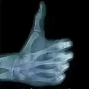 识时务者干骨科 