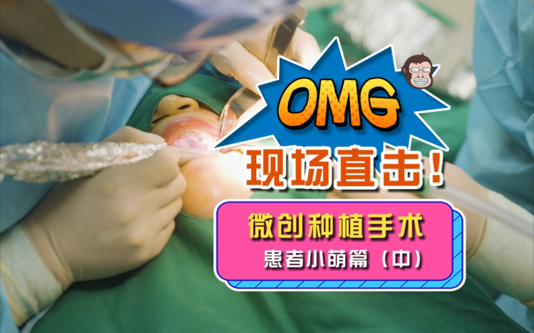 现场直击!口腔微创种植手术!