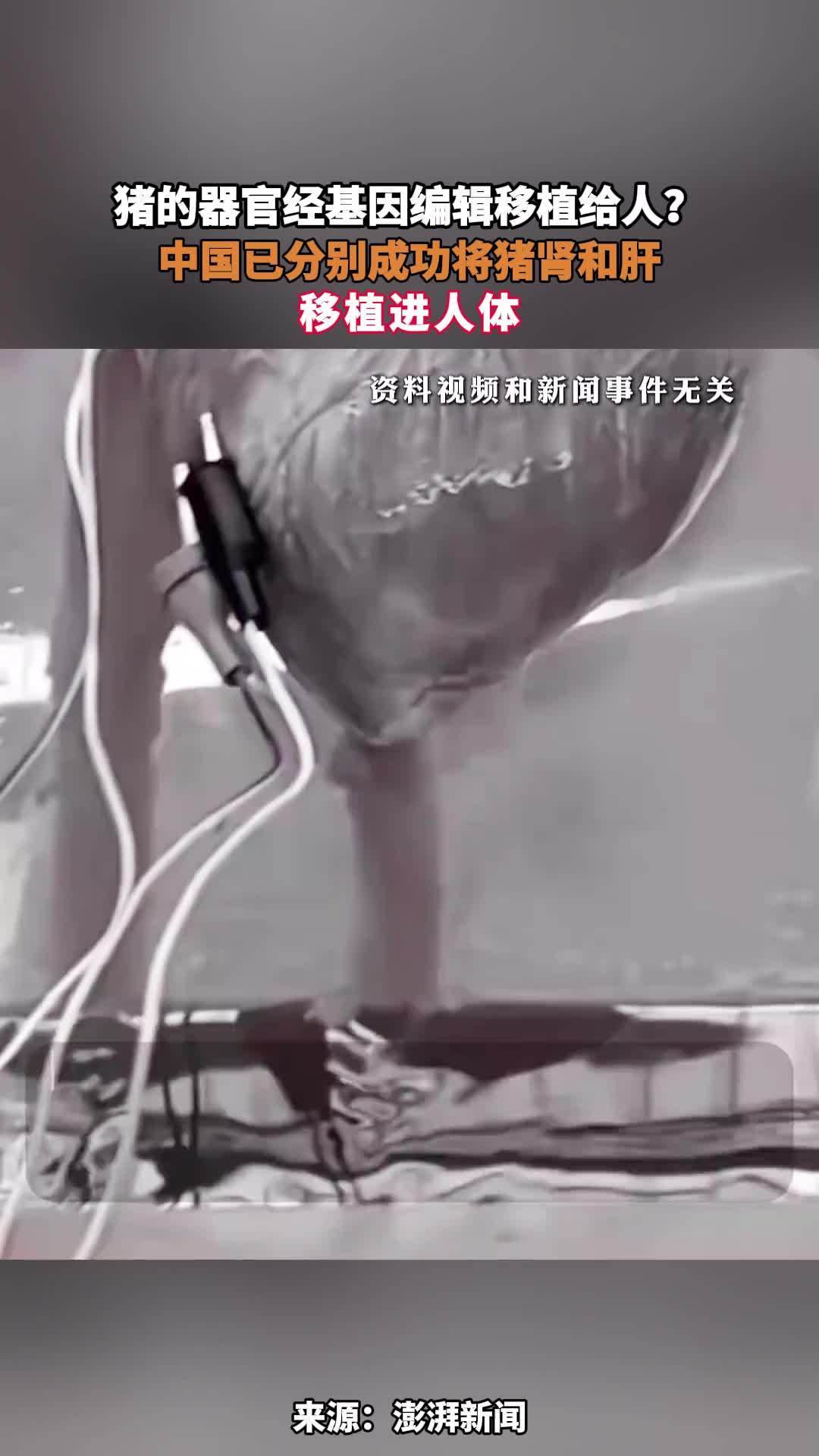 猪器官经基因编辑移植给人?中国已分别成功将猪肾和肝移植进人体