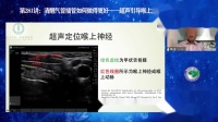 第281讲:清醒气管插管如何做的更好——超声引导喉上神经阻滞(单涛 ...
