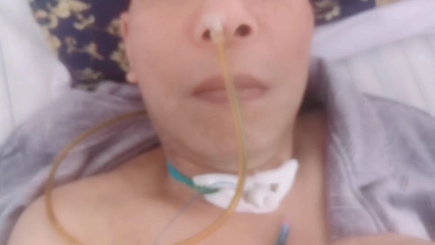 马上气切插管换管